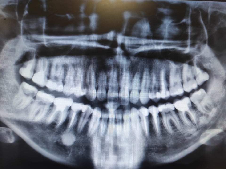 What is this? - MEDizzy