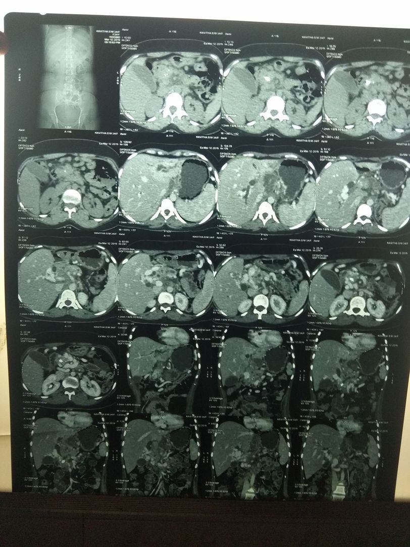 Identify the problem? - MEDizzy