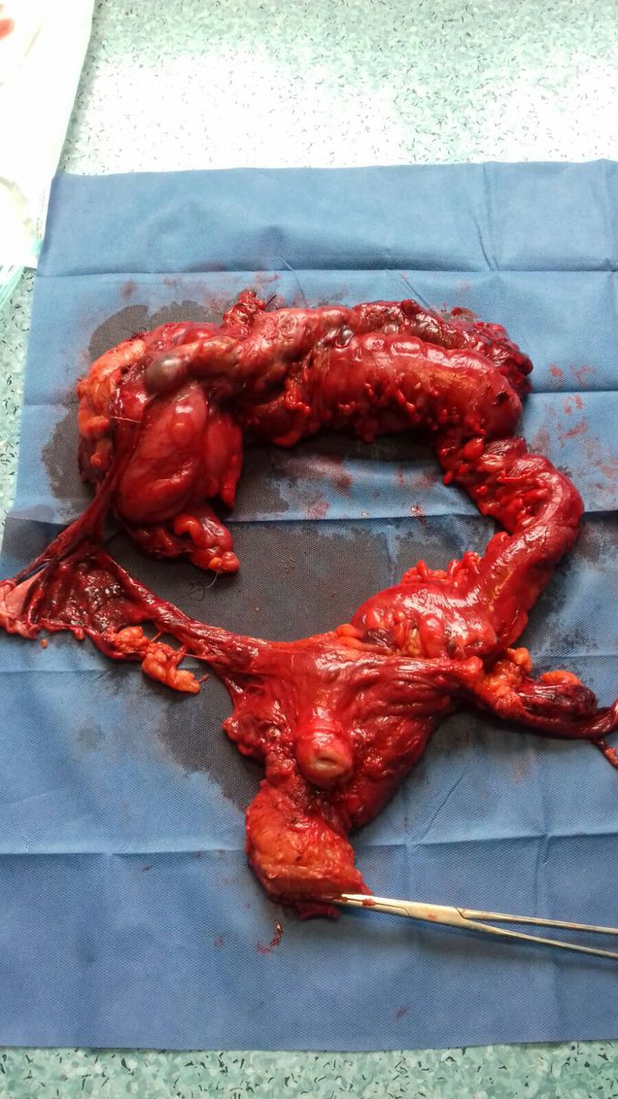 Post number 33960 - MEDizzy