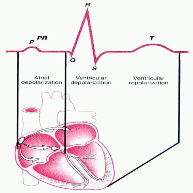 EKG/ECG - MEDizzy