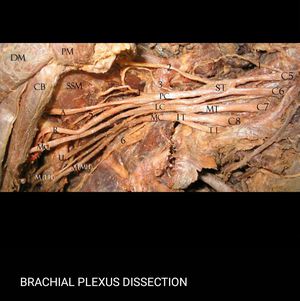 Brachial plexus dissection - MEDizzy