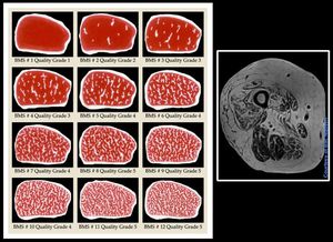 Kobe Beef anyone :) @ Siemens 3T Skyra #s_mri #siemens #mri - MEDizzy