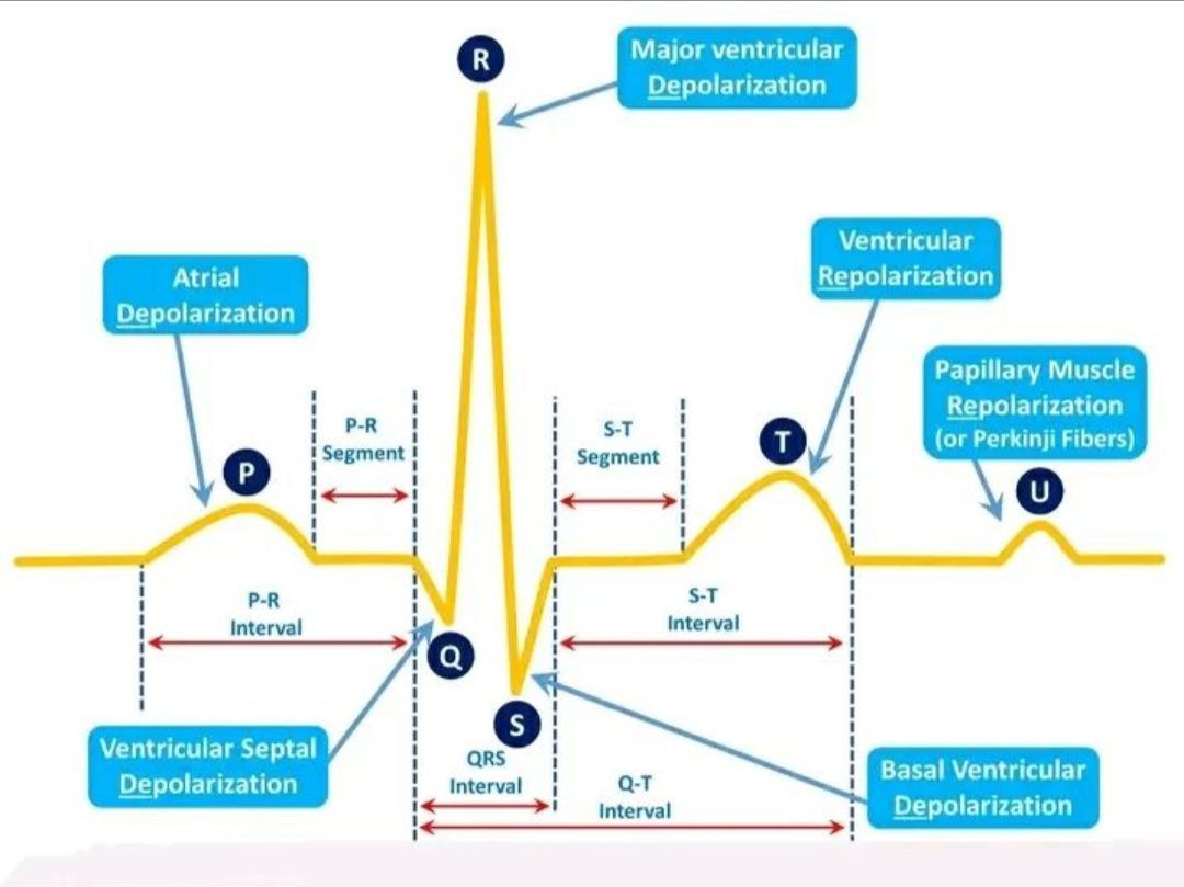ECG basics... - MEDizzy