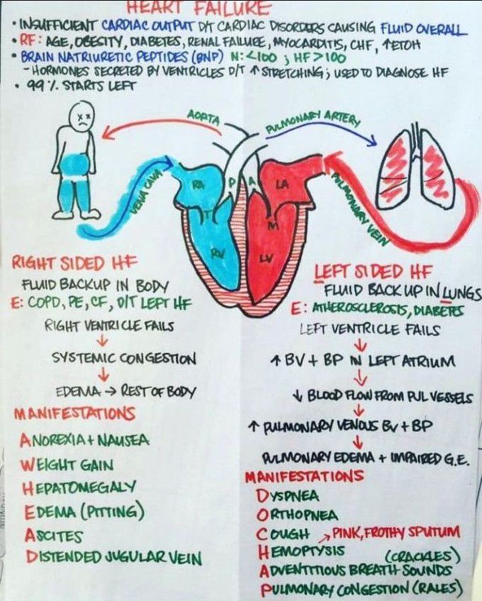 Heart failure - MEDizzy