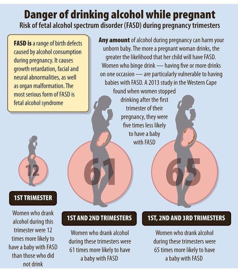 Alcohol Use Pregnancy Deformity