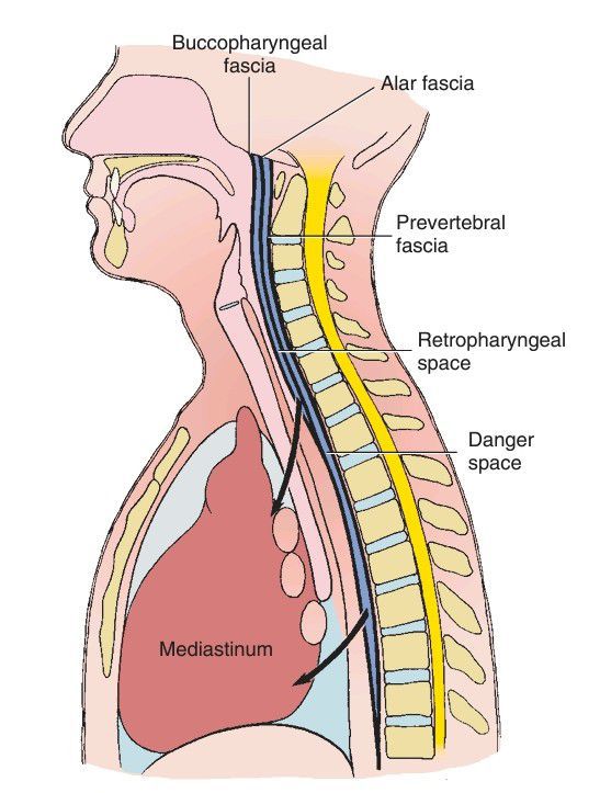 Odontogenic Infection Pathway MEDizzy