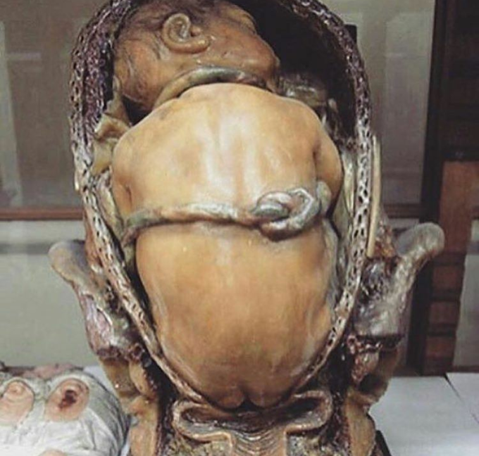 Post number 1390139 - MEDizzy