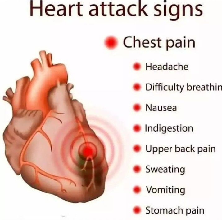 Signs of heart attack - MEDizzy