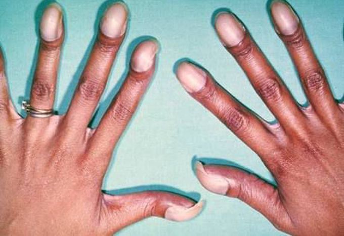 What is your spot diagnosis? - MEDizzy