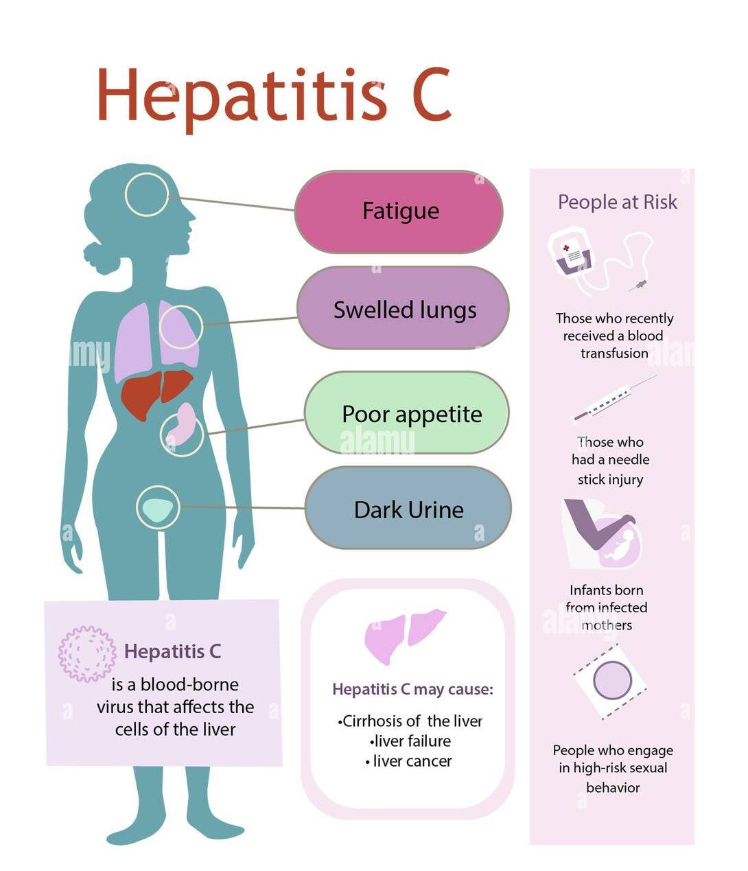Hepatitis C Causes Buy Hepatitis C: Symptoms, Diagnosis And Treatment