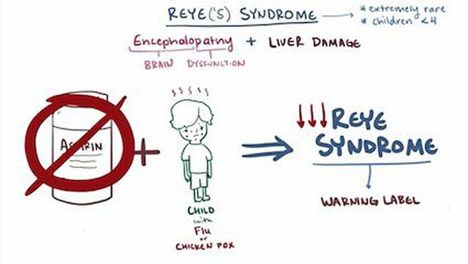 Reye's syndrome - MEDizzy