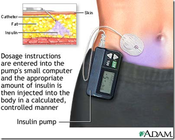 Unwanted effects of insulin - MEDizzy