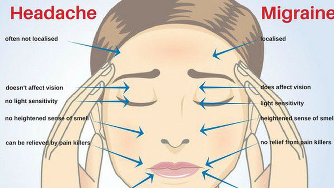 Migraine headache. - MEDizzy