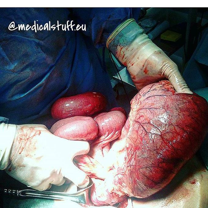 It's not every day you pull out something like this Can you - MEDizzy