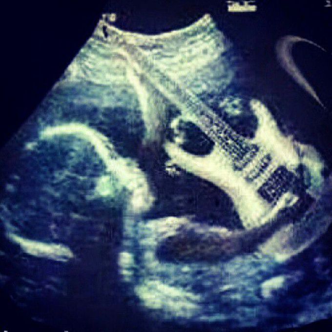 An aspiring rockstar! - MEDizzy