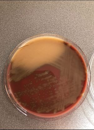 Some serious growth on “chocolate” agar - MEDizzy
