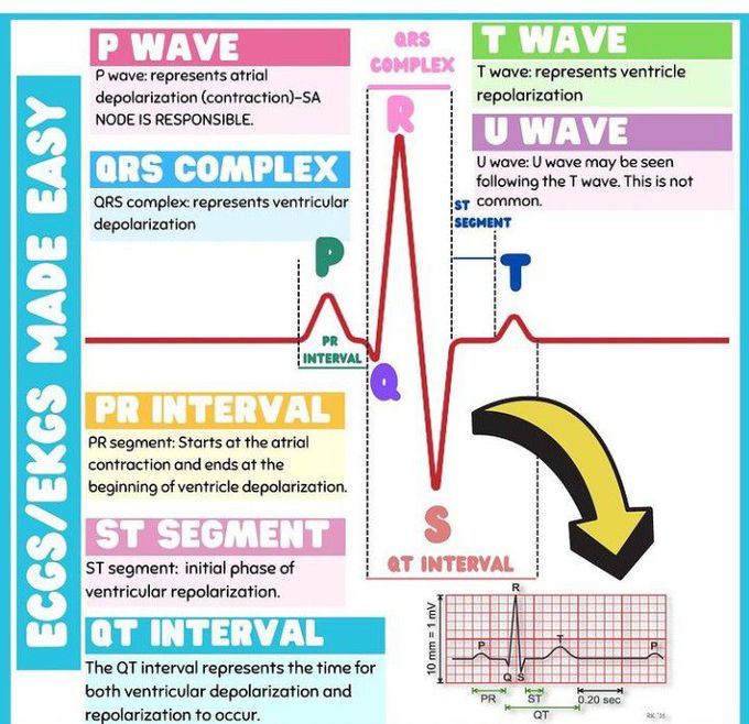 ECGS made easy - MEDizzy