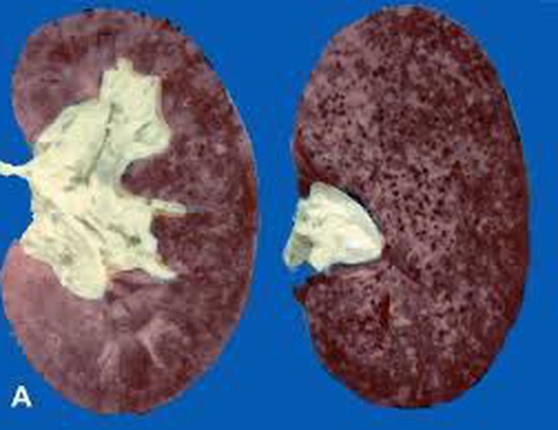 Pathology question of the day - MEDizzy