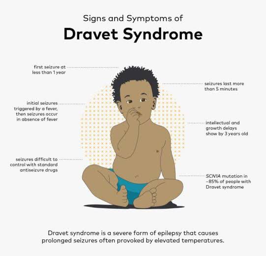 These Are The Symptoms Of Dravet Syndrome MEDizzy