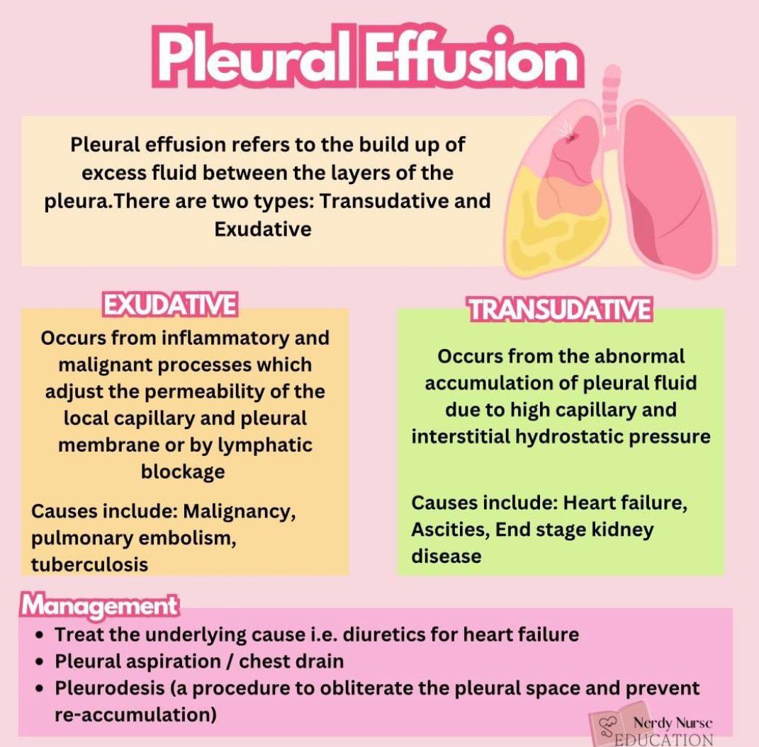Pleural Effusion - MEDizzy
