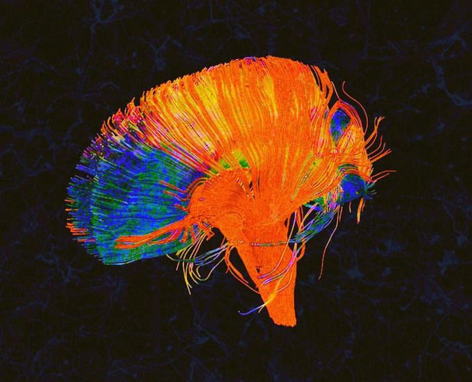 "Synthetic brain" - MEDizzy