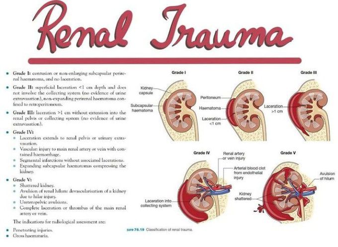 Renal trauma - MEDizzy