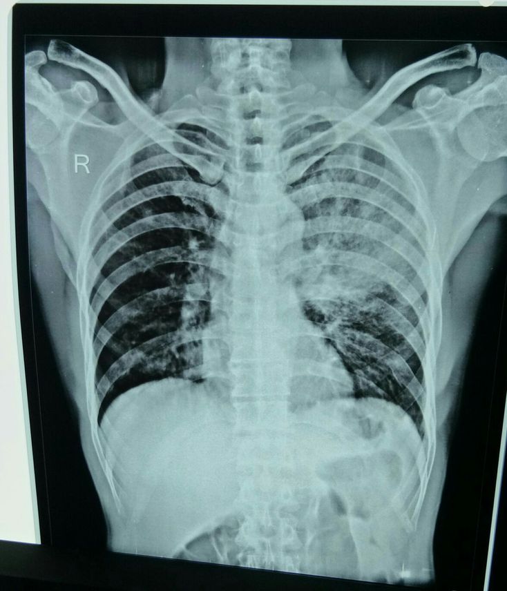 Diagnosis fast - MEDizzy