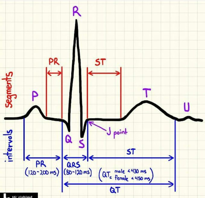 ECG basic - MEDizzy