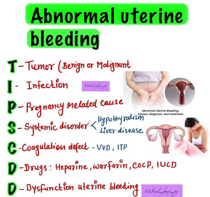 Abnormal Uterine Bleeding - MEDizzy