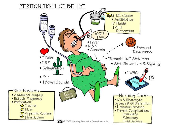Peritonitis - MEDizzy