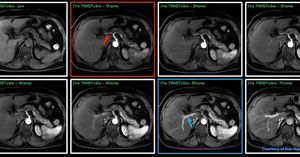 Key points to look at whether you have timed correctly doing - MEDizzy
