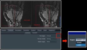 Improved homogenous FatSat for MSK imaging @ Siemens 1.5T - MEDizzy