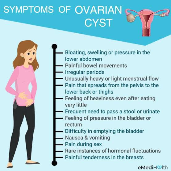 Ovarian Cyst Symptoms MEDizzy