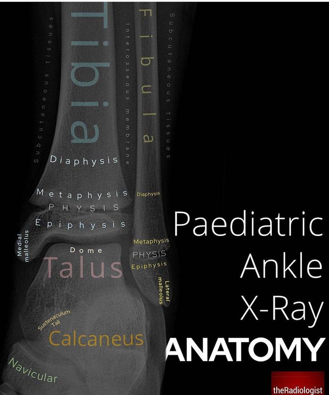 Pediatric Ankle - MEDizzy