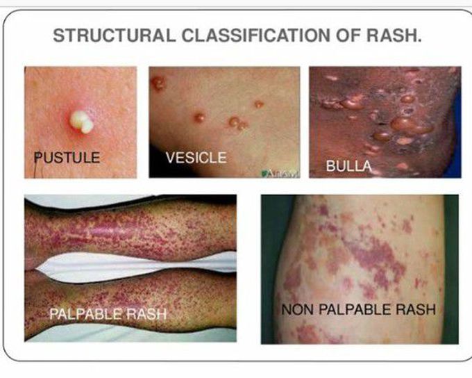 Post number 1505064 - MEDizzy