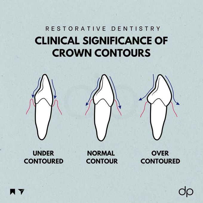 Significance of crown contour - MEDizzy