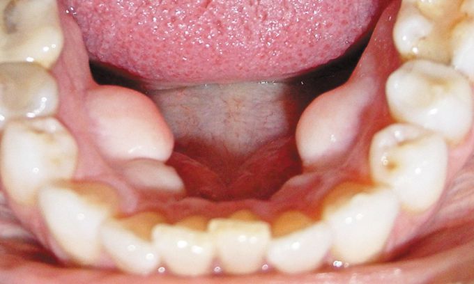 A 62-year-old woman presented for a routine dental - MEDizzy