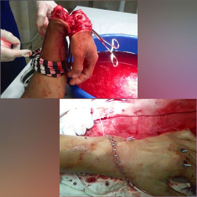 When you overuse your hand but they get you perfectly - MEDizzy