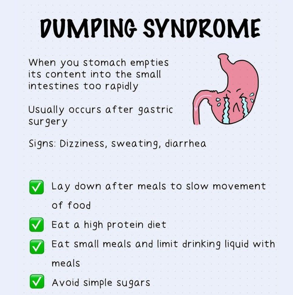Dumping Syndrome - MEDizzy