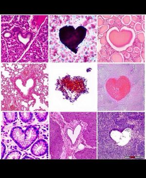 Humans know about love?! - MEDizzy