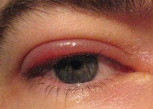 condition? - MEDizzy