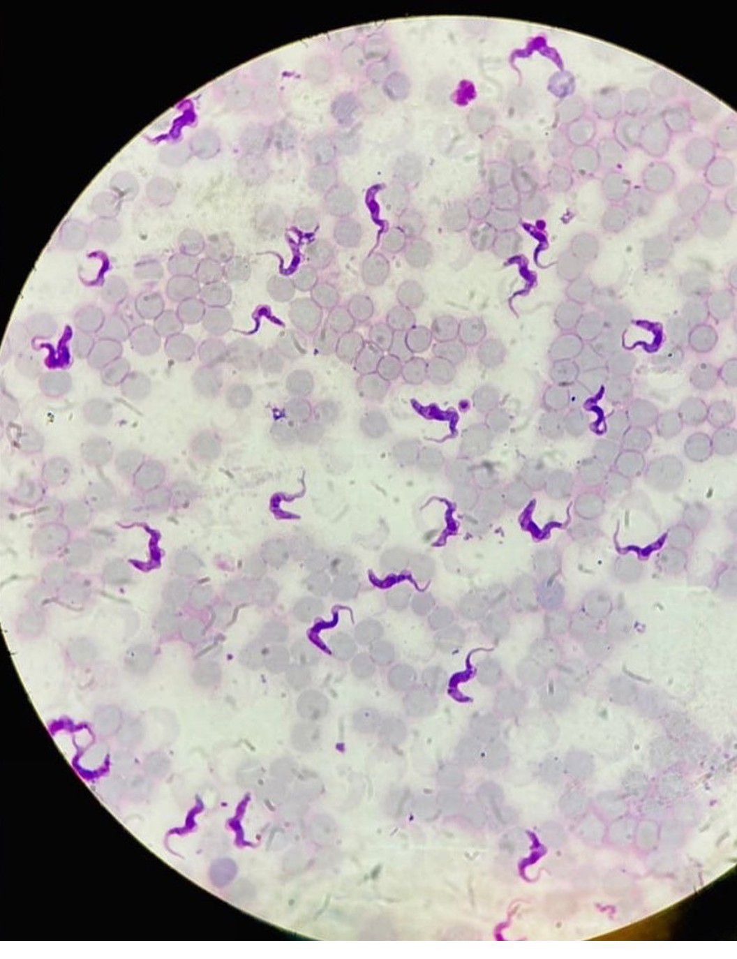 Trypanosoma Under Microscope