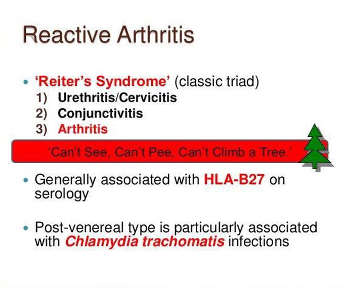 Reactive arthritis - MEDizzy