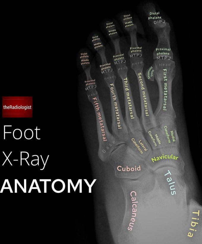 Foot X ray Anatomy MEDizzy