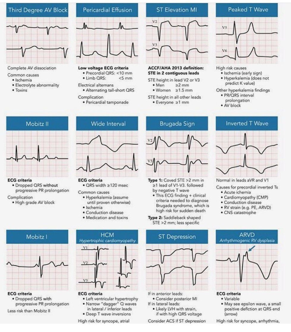 Cardiology Review - MEDizzy