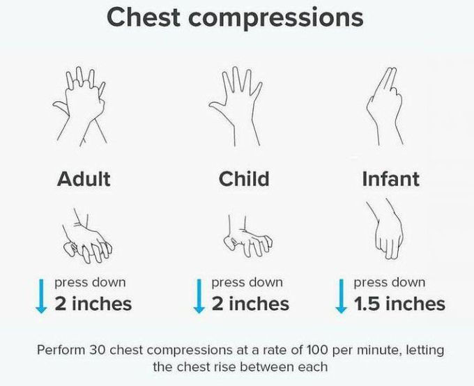 Chest Compressions - MEDizzy