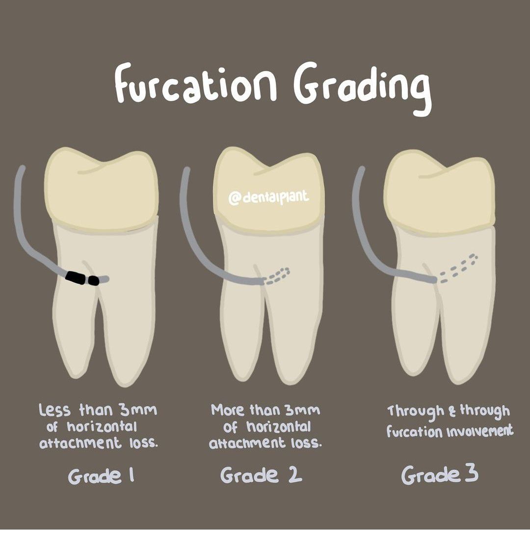 Furcation Grading MEDizzy