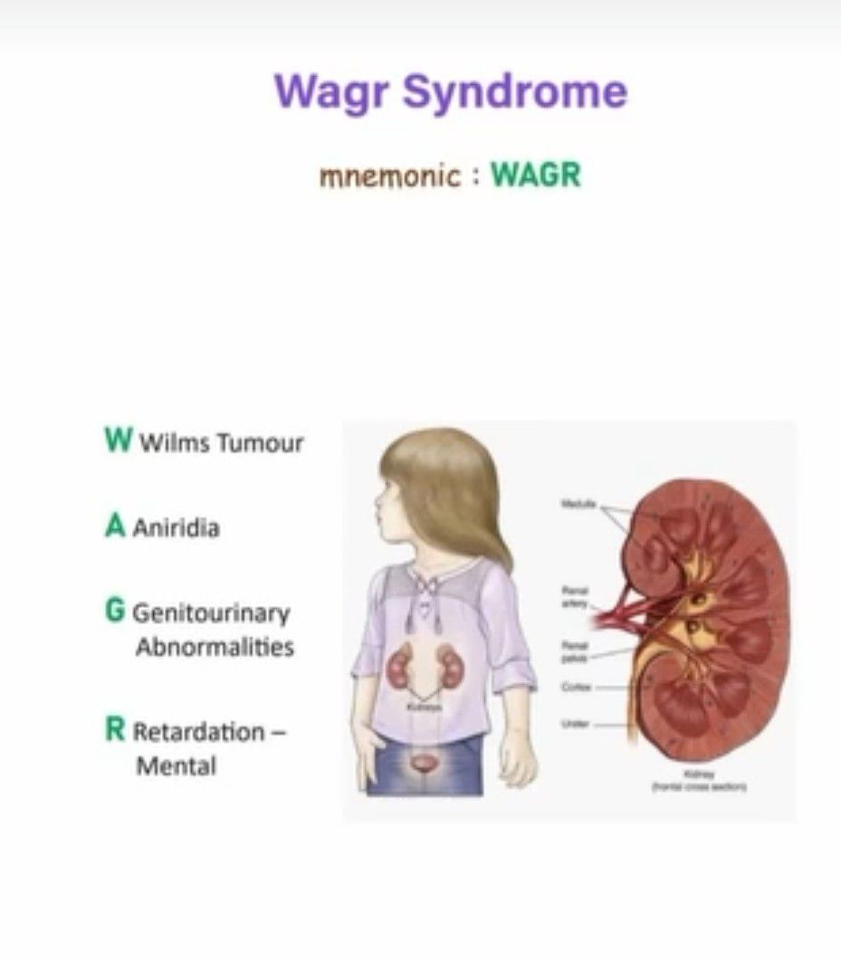 Wagr Syndrome - MEDizzy