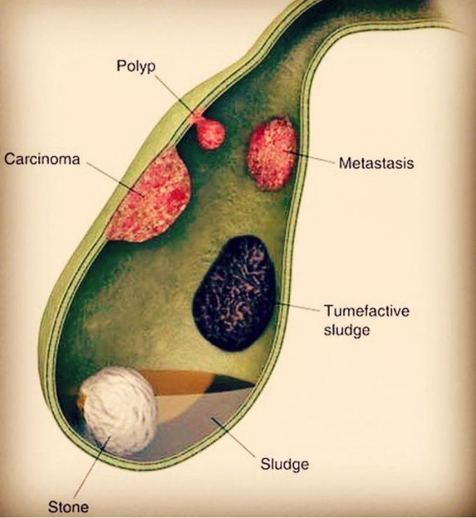 Gall bladder - MEDizzy
