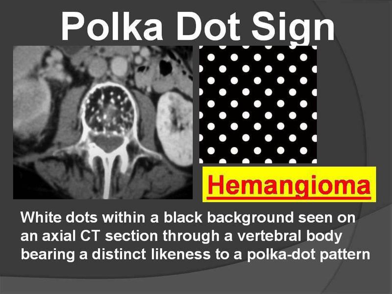 Polka dot sign - MEDizzy
